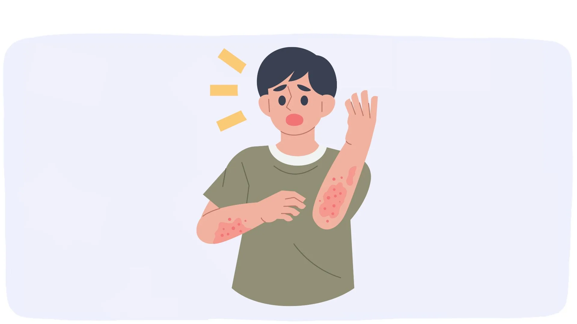 L'incidence des allergies sur l'eczéma | Blog - Doctoome